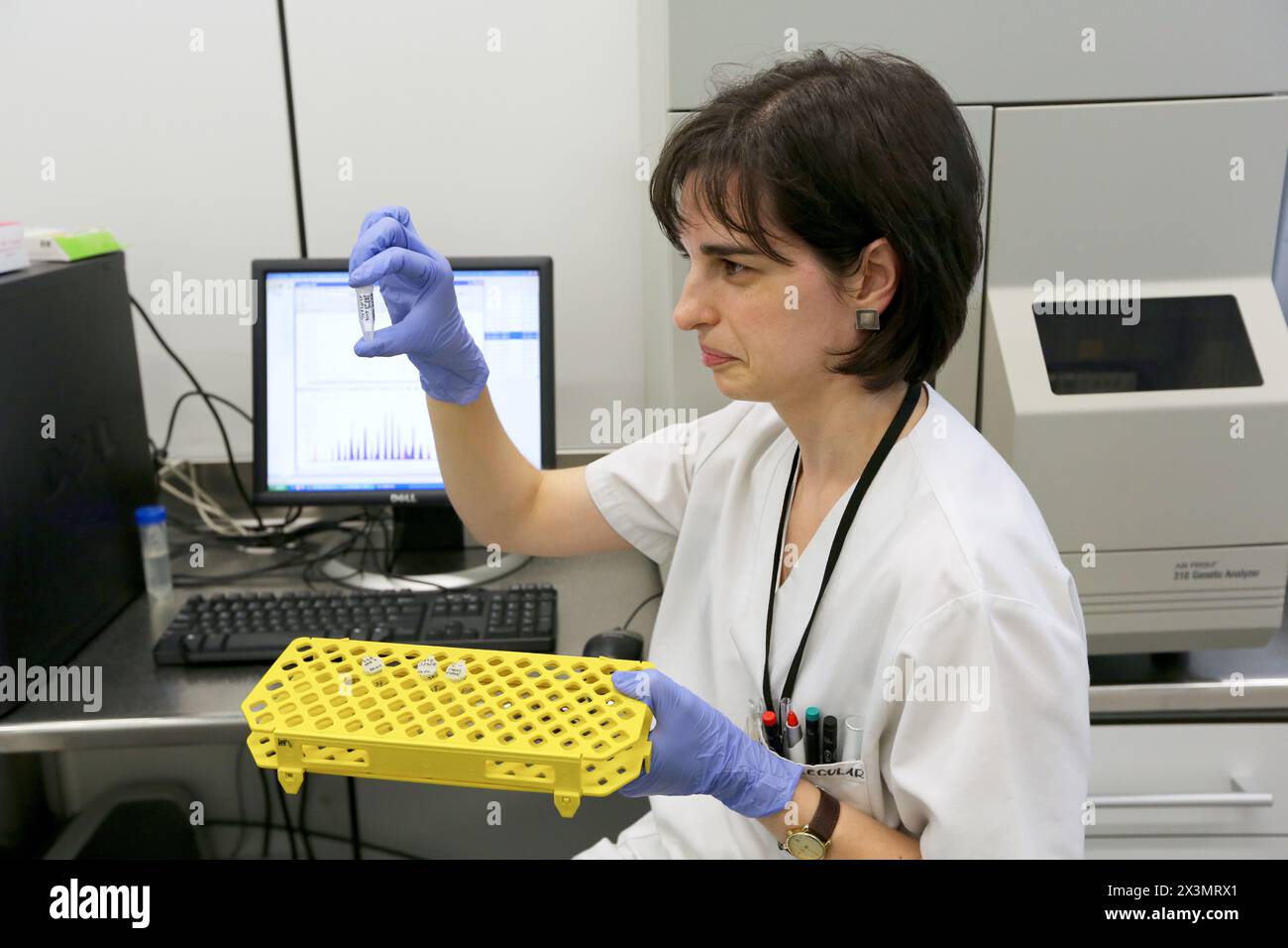 Extraction of DNA from lung tumor biopsies for EGFR gene mutation study ...