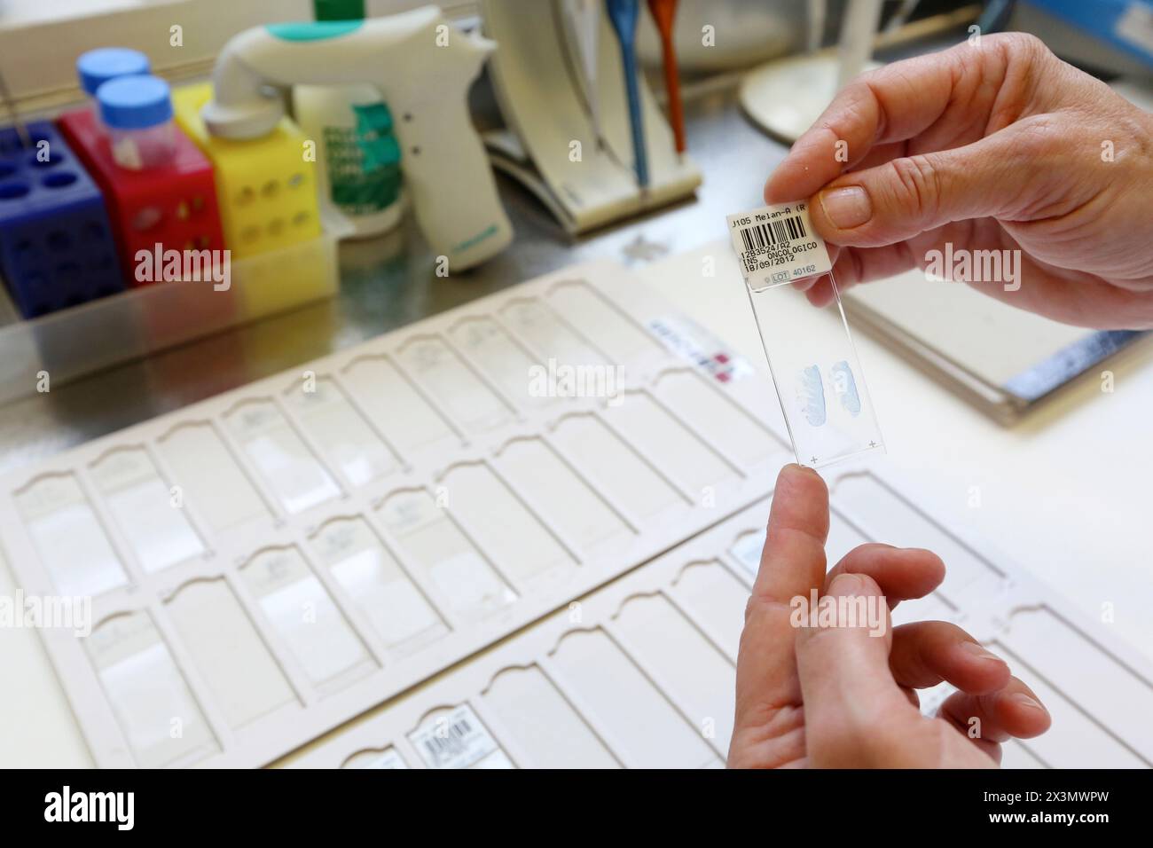 Perianal hi-res stock photography and images - Alamy