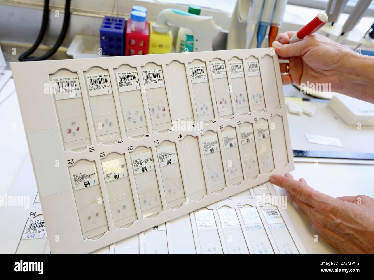 zebrafish samples, Slides stained with immunohistochemistry technique ...