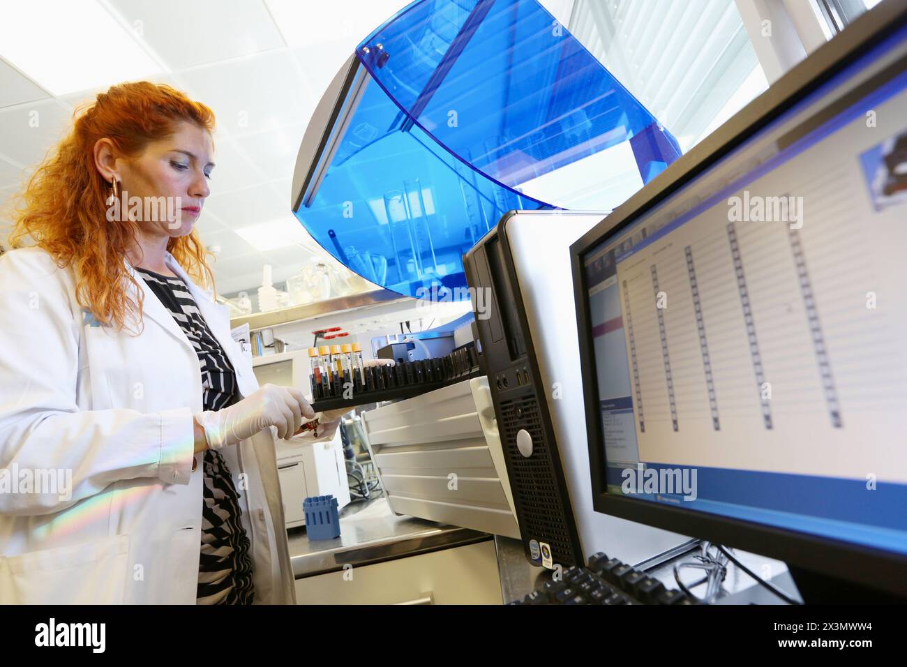 Enzyme immunoassay analysis, Automated ELISA Processing System ...
