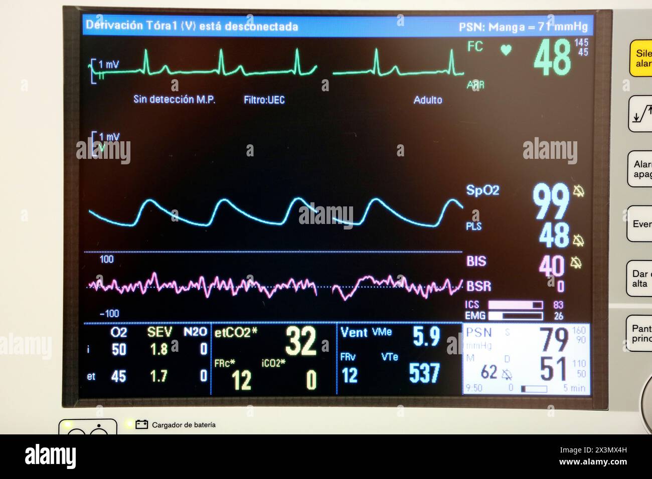 anesthetist and display vital signs, Onkologikoa Hospital, Oncology ...