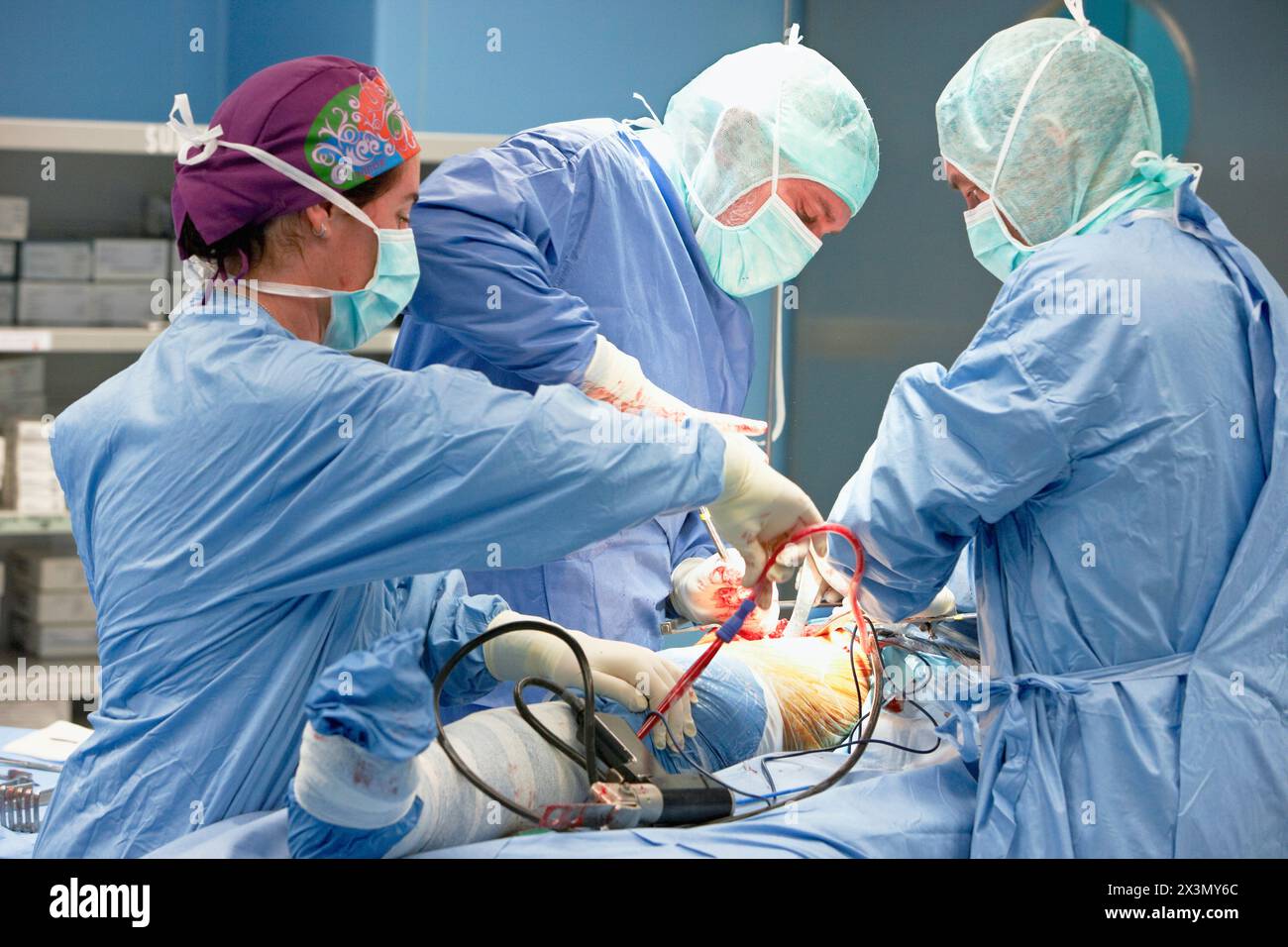 Hip joint replacement, traumatology operating room. Hospital ...