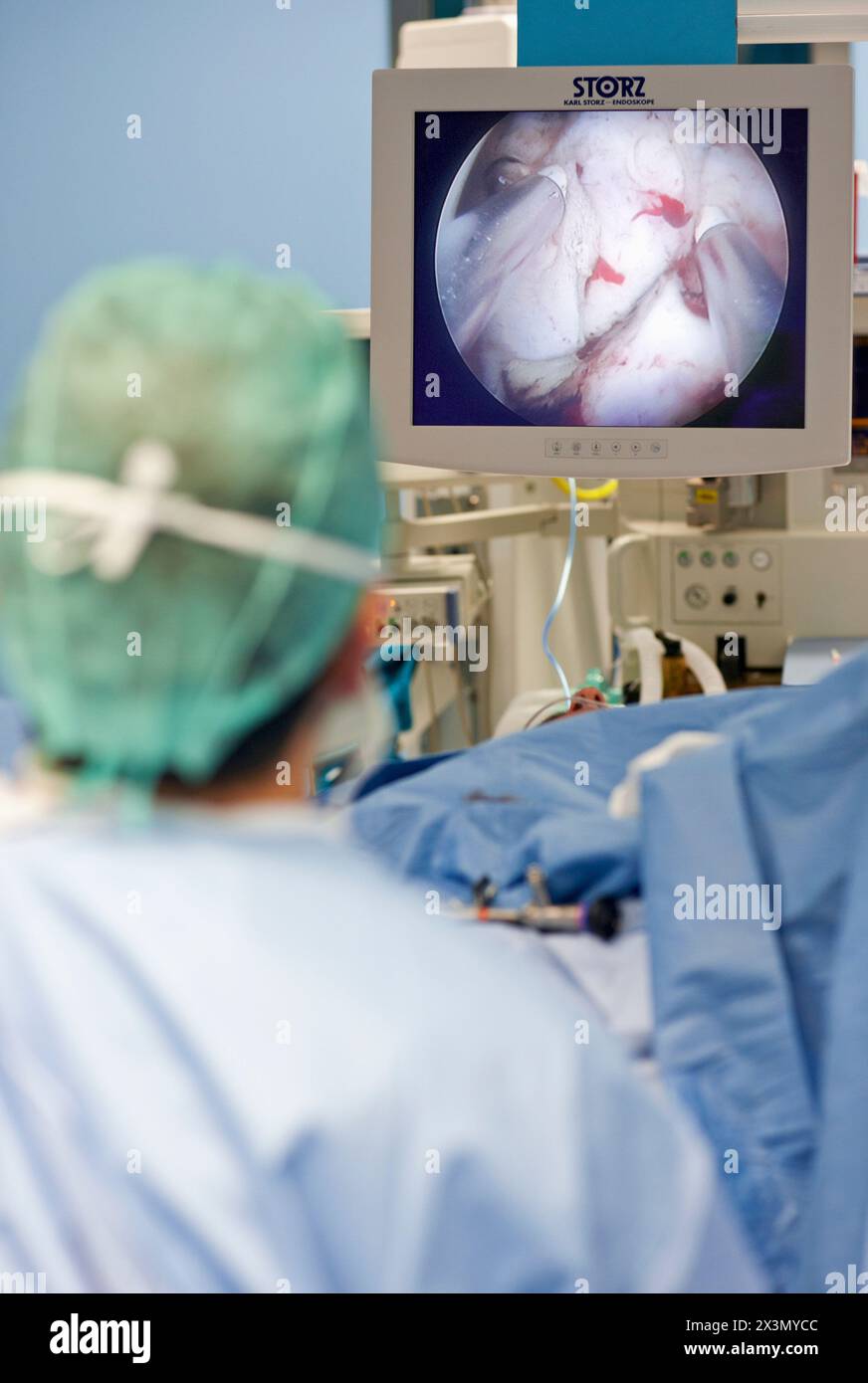 Transurethral resection hi-res stock photography and images - Alamy