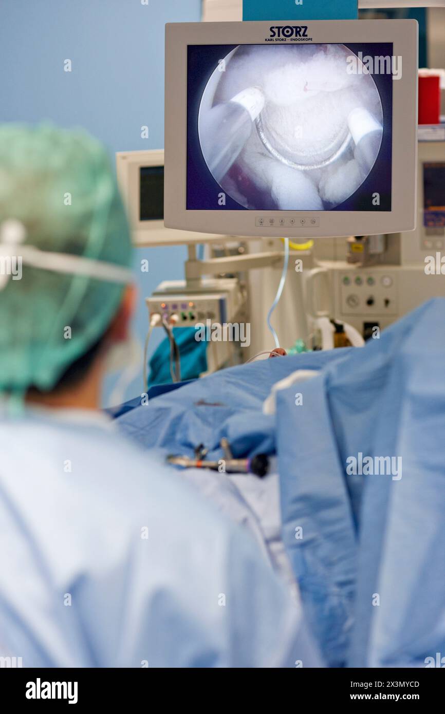 Prostate surgery, bipolar TURP (transurethral resection of the prostate ...