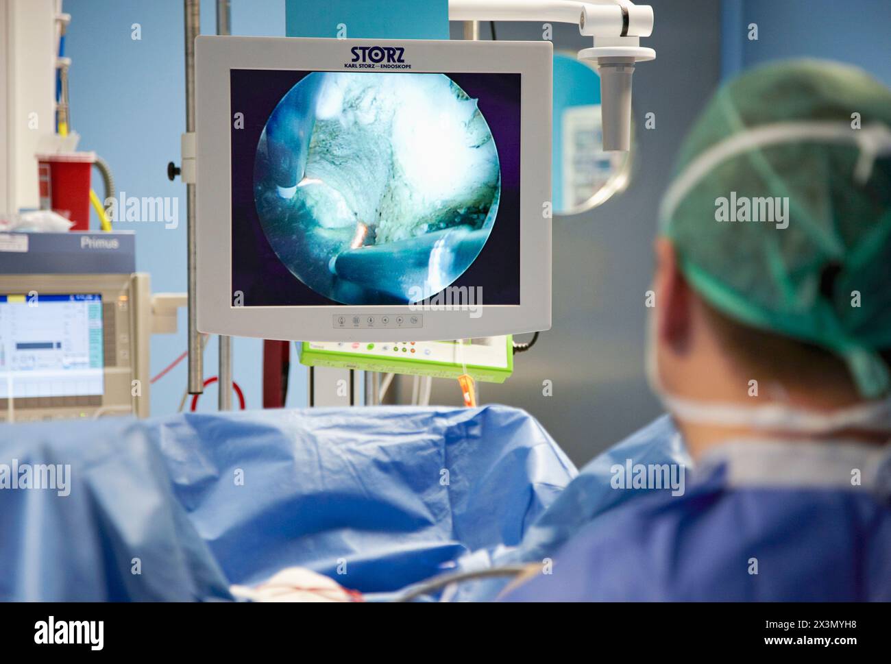 Prostate surgery, bipolar TURP (transurethral resection of the prostate ...