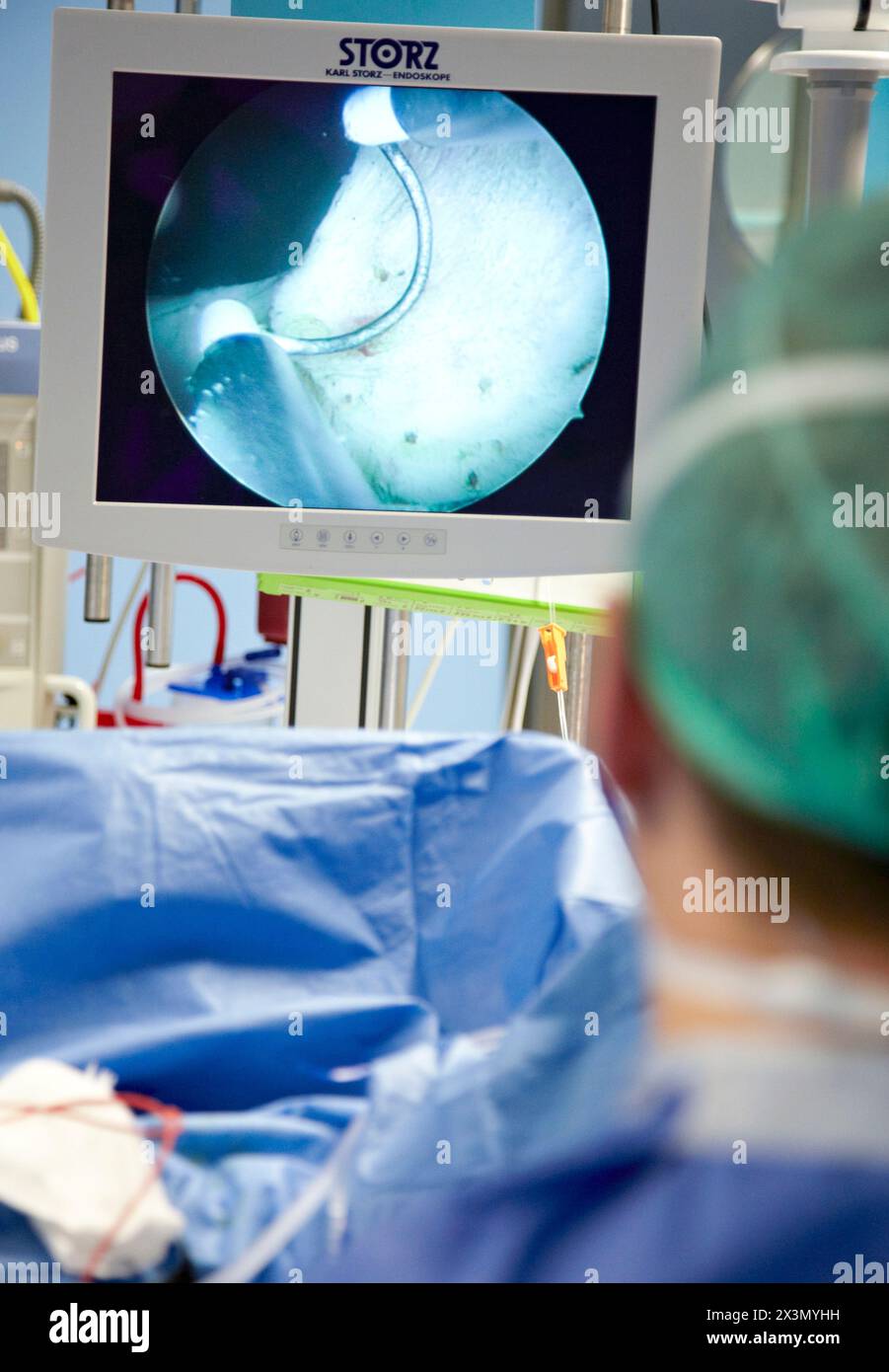 Prostate surgery, bipolar TURP (transurethral resection of the prostate ...