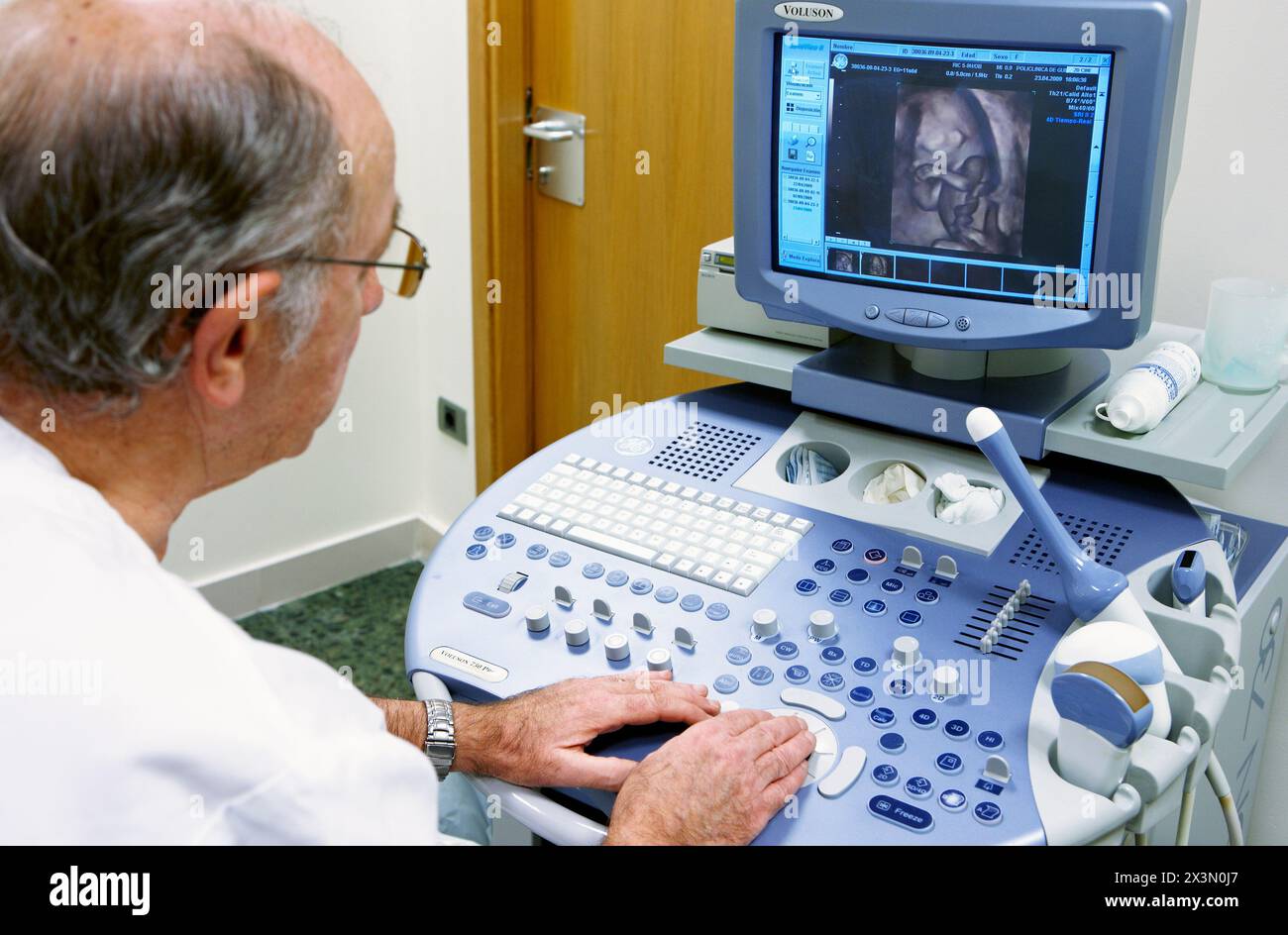 Ultrasound scan baby colour hi-res stock photography and images - Alamy