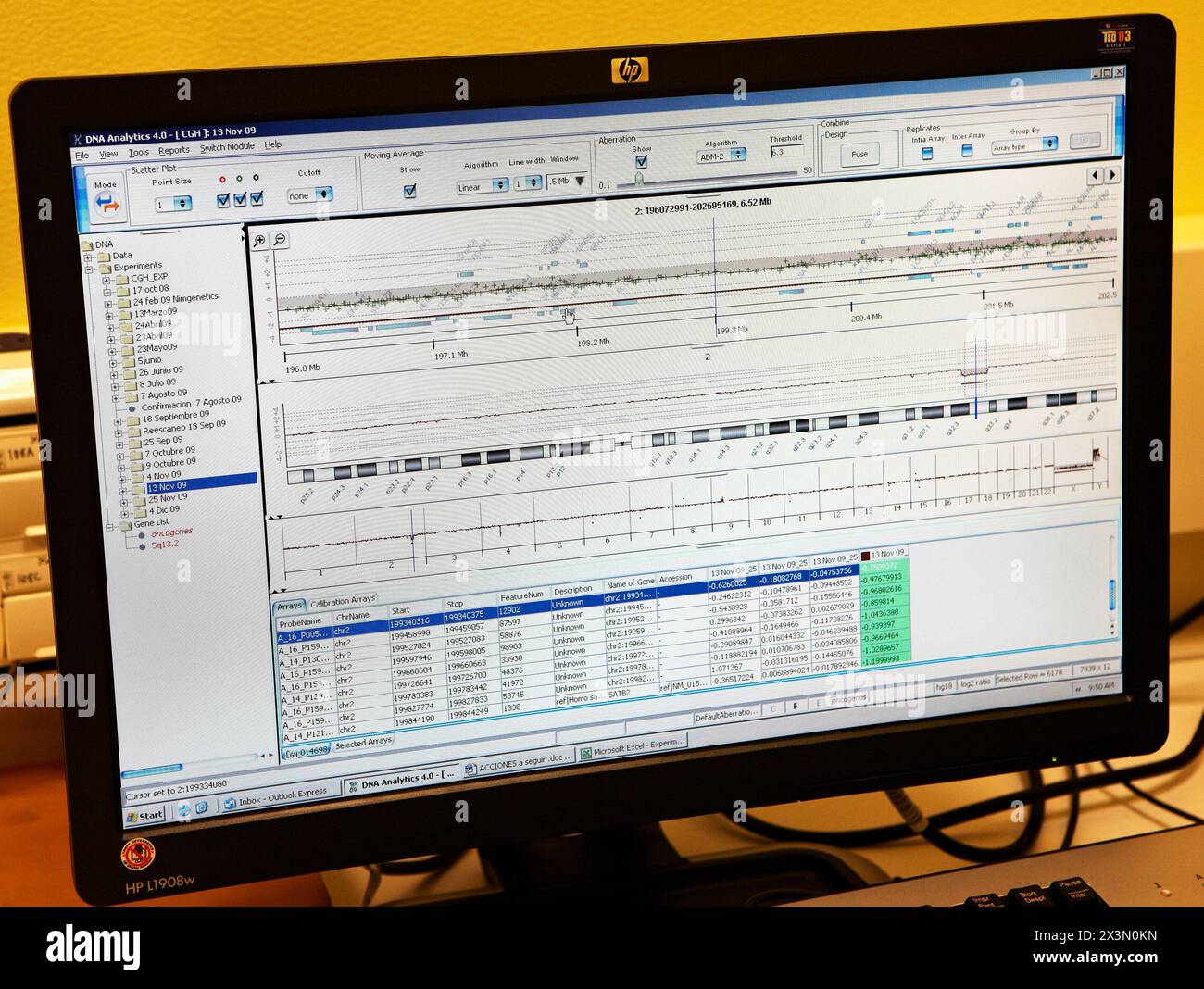 Analysis of 105 000 pieces of human DNA, prenatal diagnosis using Array ...