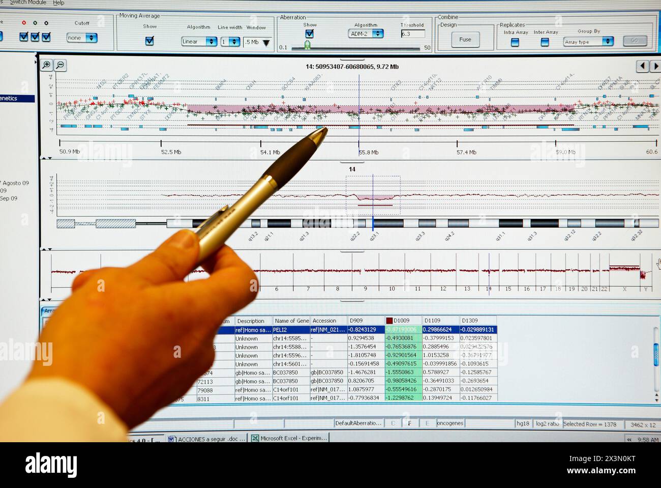 Analysis of 105 000 pieces of human DNA, prenatal diagnosis using Array ...