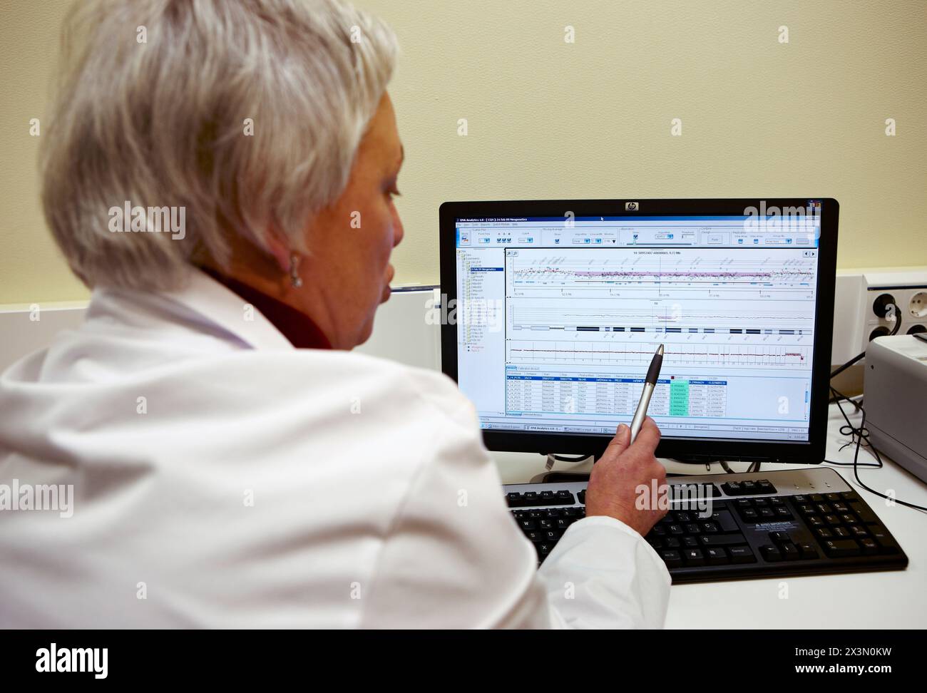 Analysis of 105 000 pieces of human DNA, prenatal diagnosis using Array ...
