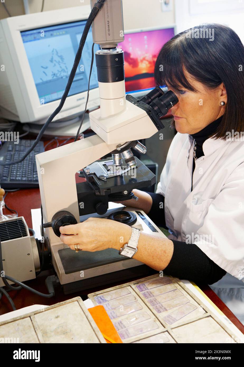 FISH (Fluorescent in situ hybridization) technique to detect the ...