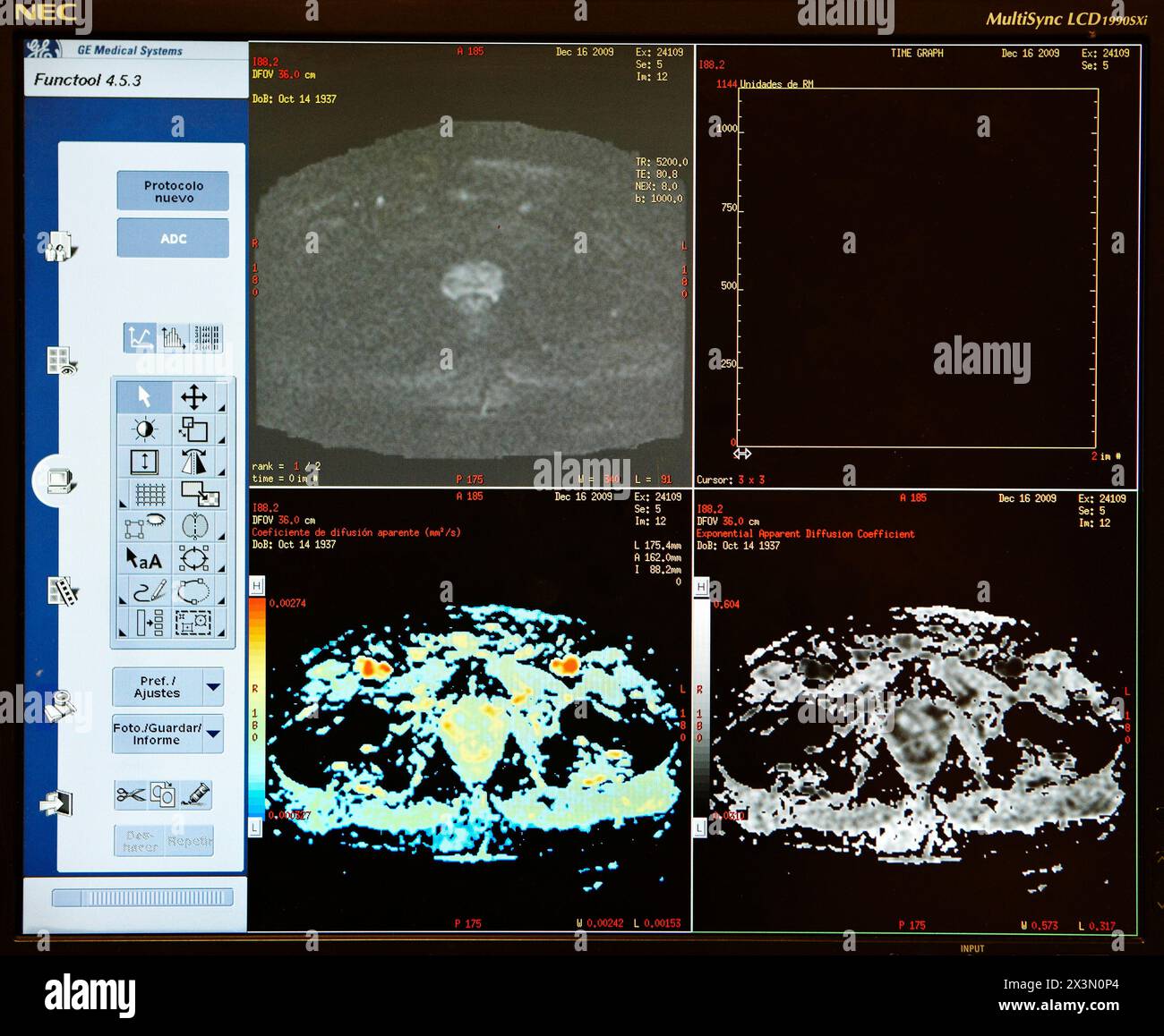 Hd scan hi-res stock photography and images - Alamy