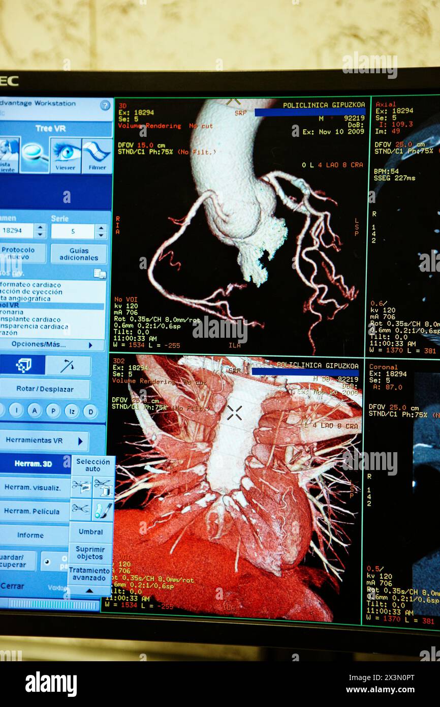 Heart anatomy images hi-res stock photography and images - Alamy