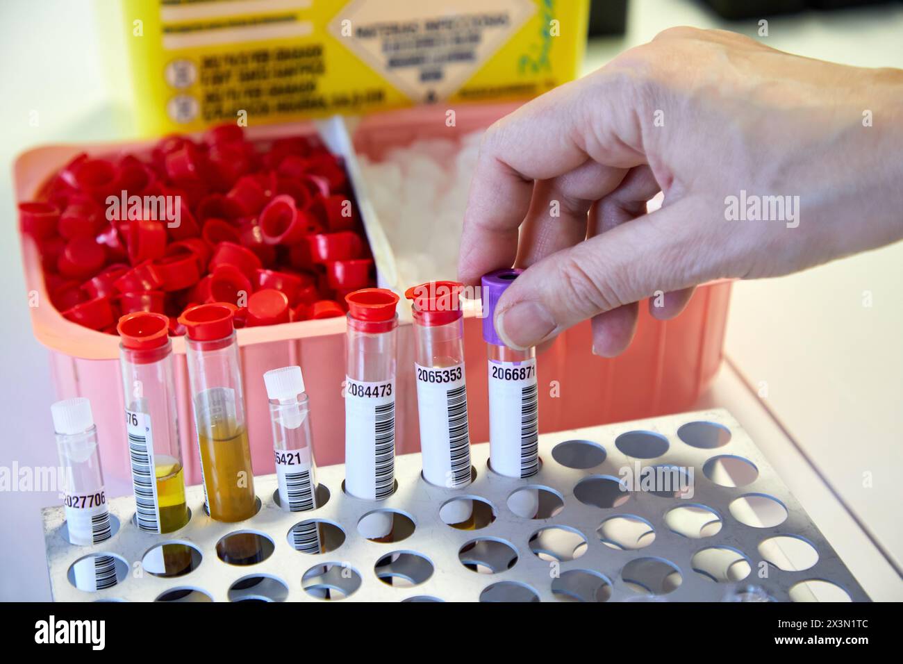 Blood samples, Hematology, Hospital Donostia, San Sebastian, Gipuzkoa ...
