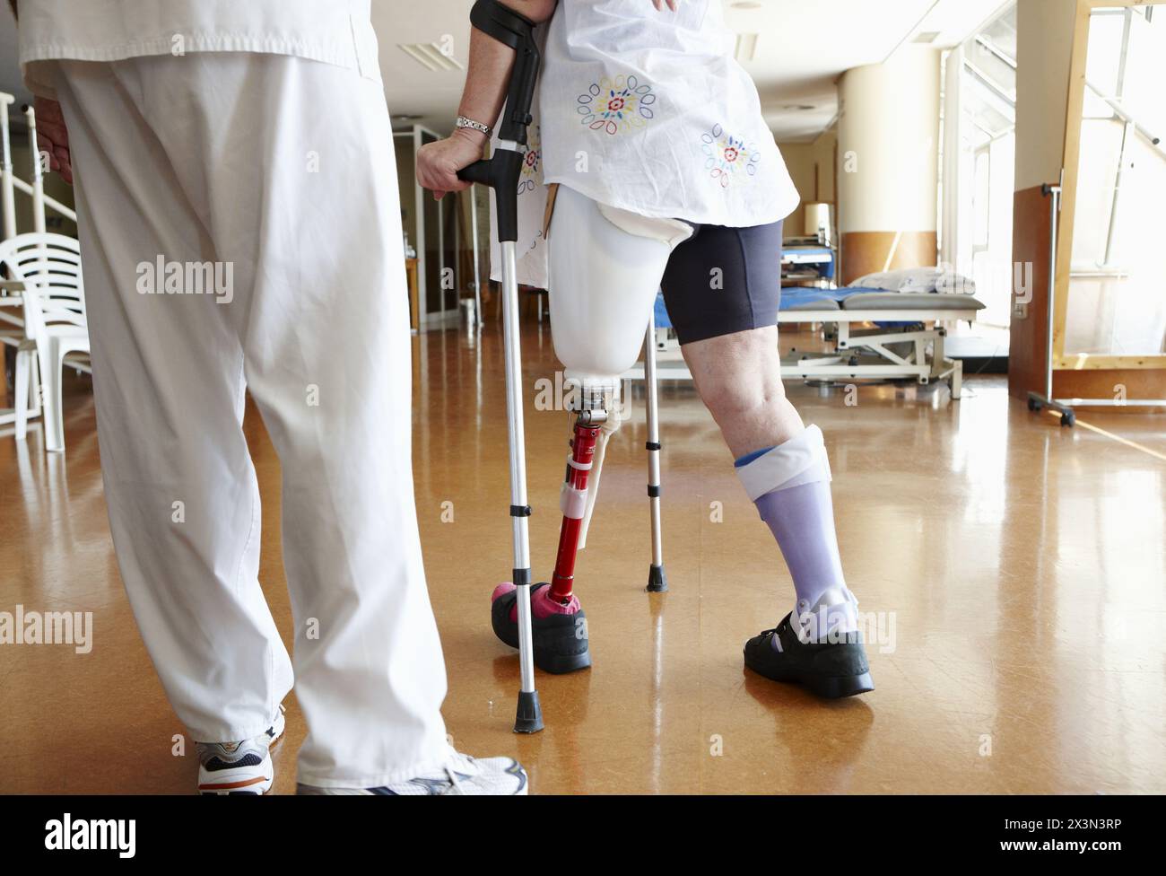 Leg amputation hi-res stock photography and images - Alamy