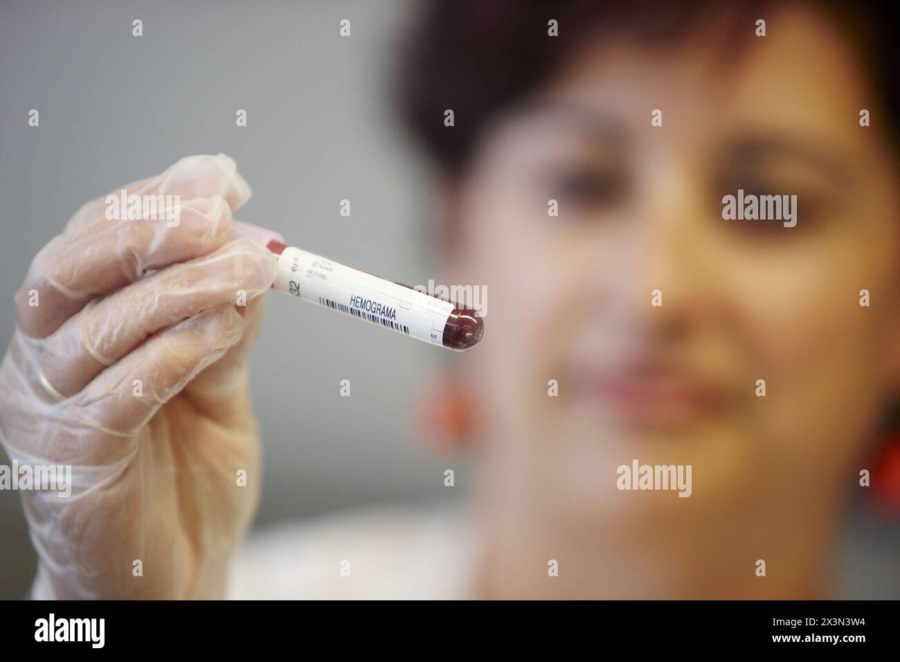 Blood sample, haematology. Hospital Universitario de Gran Canaria ...