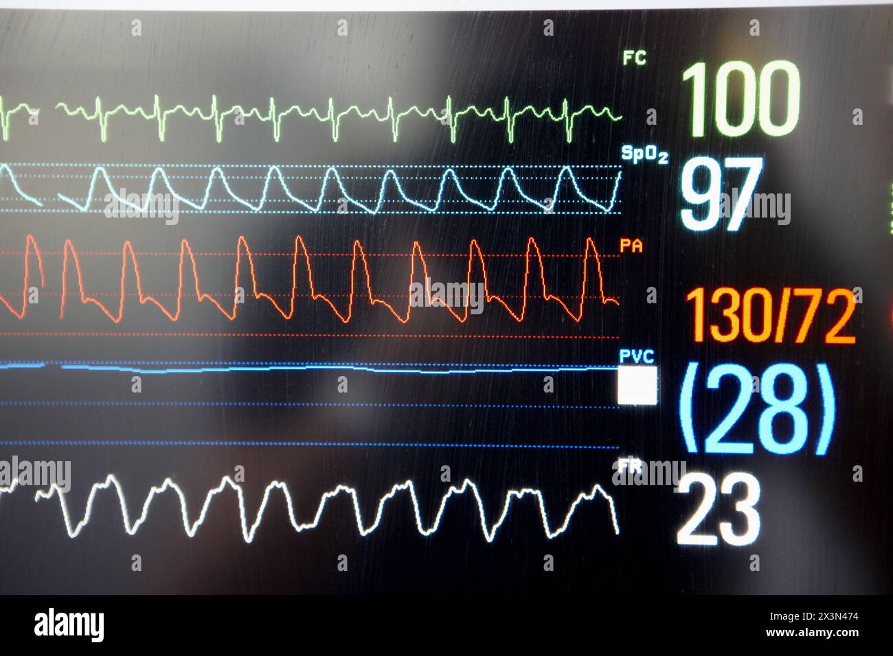 Vital signs resuscitation unit hi-res stock photography and images - Alamy