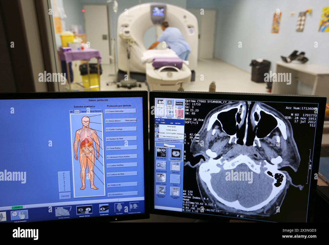 Radiology Interpretation Screen, CAT, Computarized Axial Tomography ...