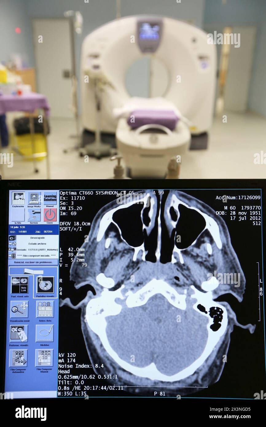 Radiology Interpretation Screen, CAT, Computarized Axial Tomography ...
