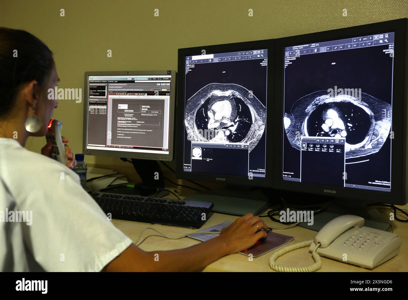 Abdominopelvic cavity hi-res stock photography and images - Alamy