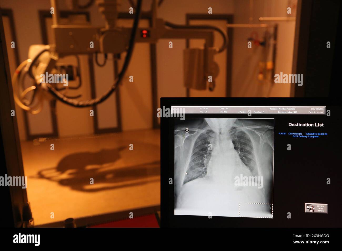 Chest x ray images hi-res stock photography and images - Alamy