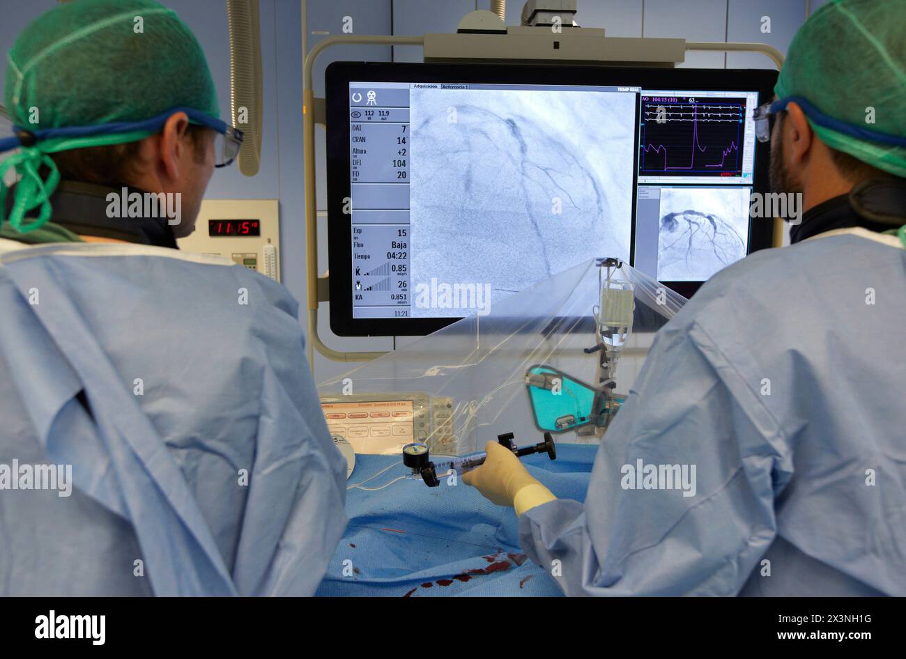 Angioplasty, Stenting in coronary arteries, Hemodynamic, Operating room ...