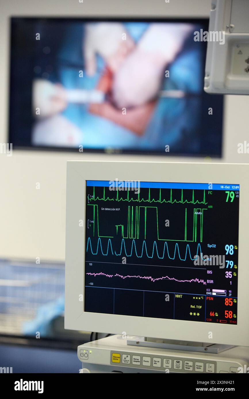 Vital signs monitors, Intervention prostate, Urology operating room ...