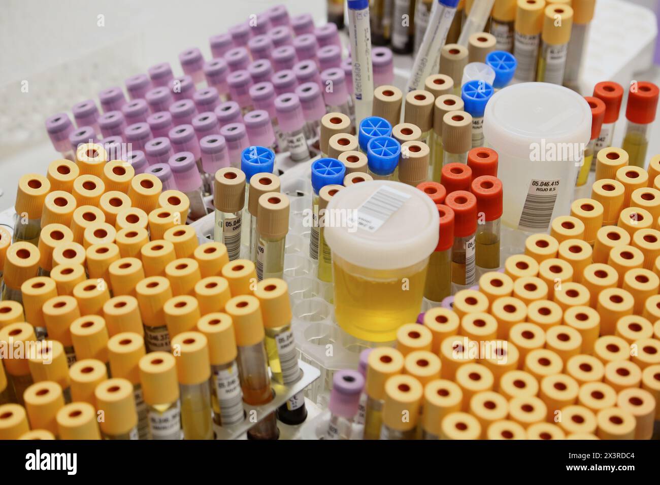 Complete Blood Count CBC or Hemogram, Hemotherapy, Donostia Hospital ...