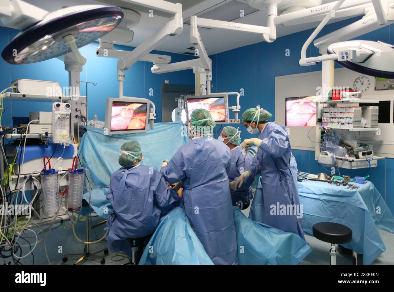 Hiatal Hernia Surgery, Laparoscopy, General Emergency Surgery ...
