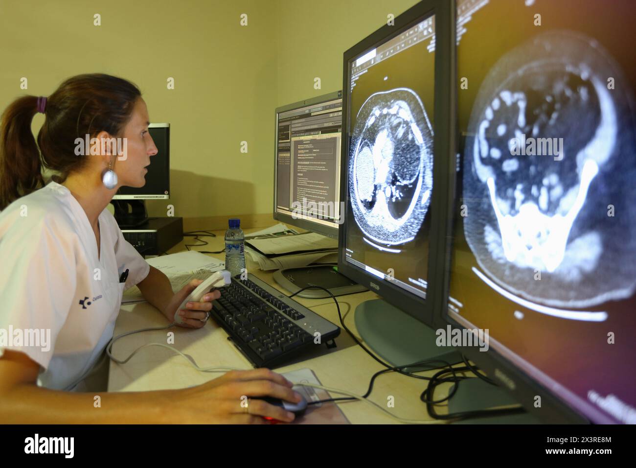 Abdominopelvic CT scan, Radiology Interpretation Review, Radiology ...