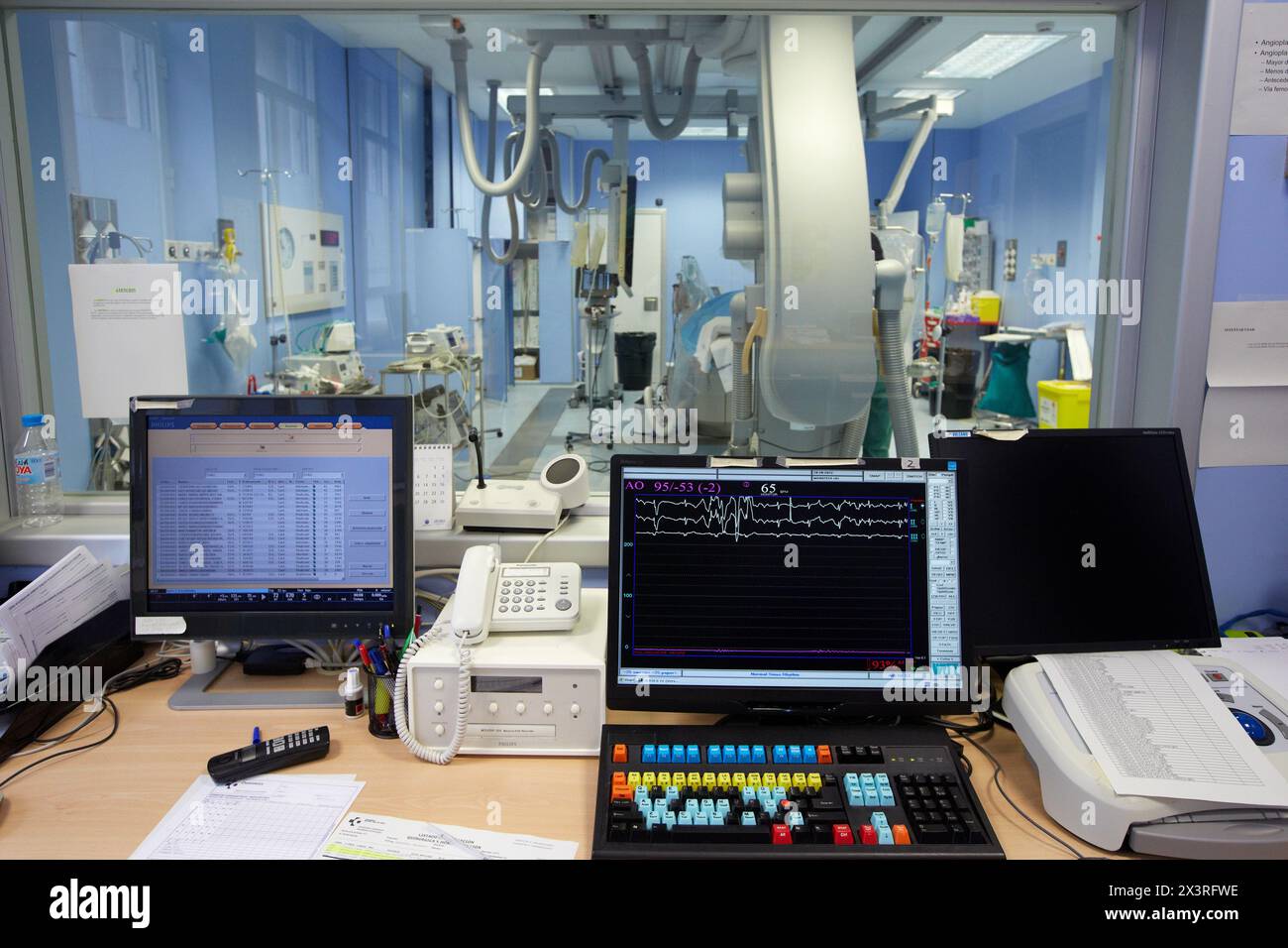 Angioplasty, Stenting in coronary arteries, Hemodynamic, Operating room ...