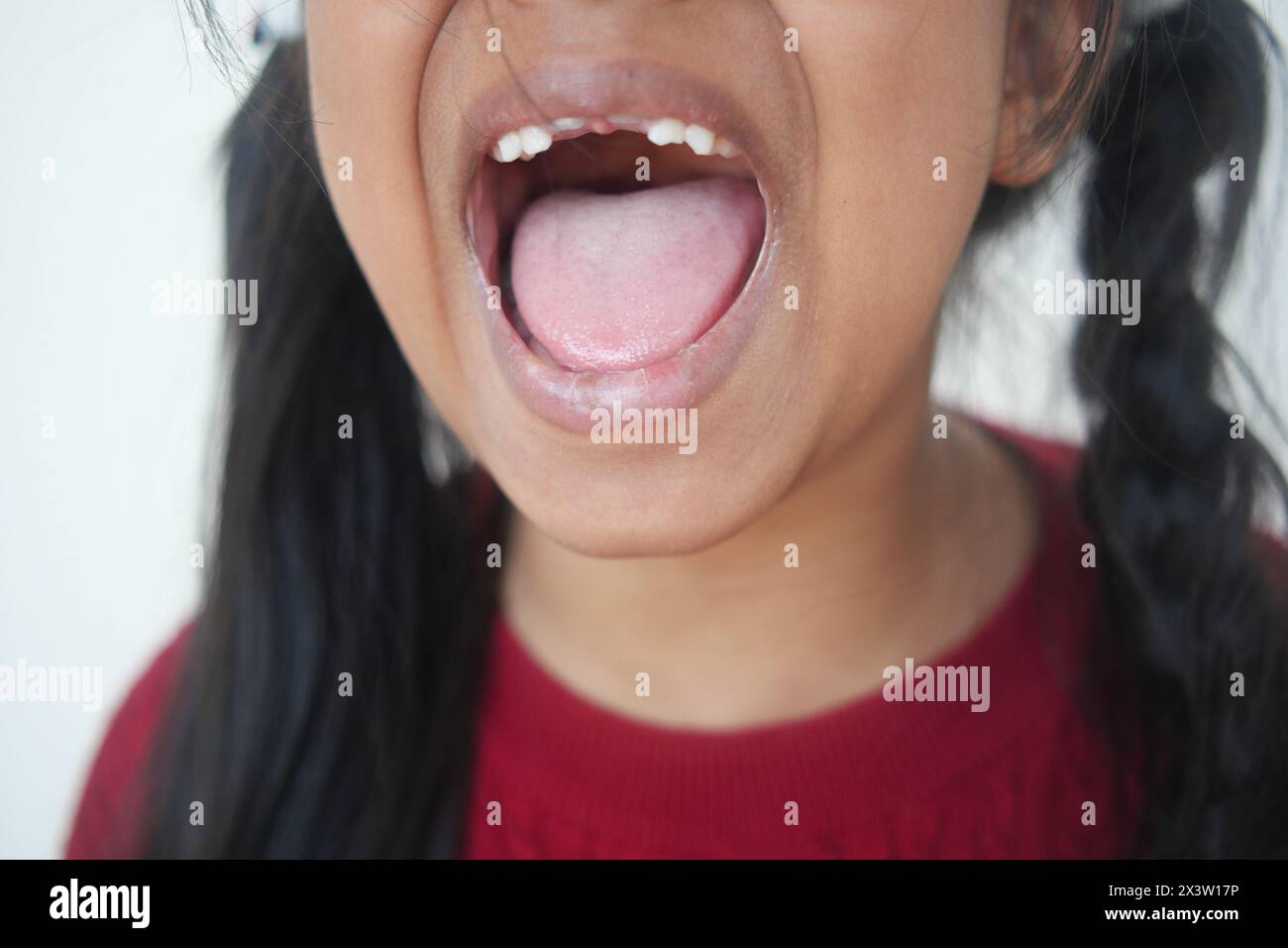 Child pain screaming hi-res stock photography and images - Alamy