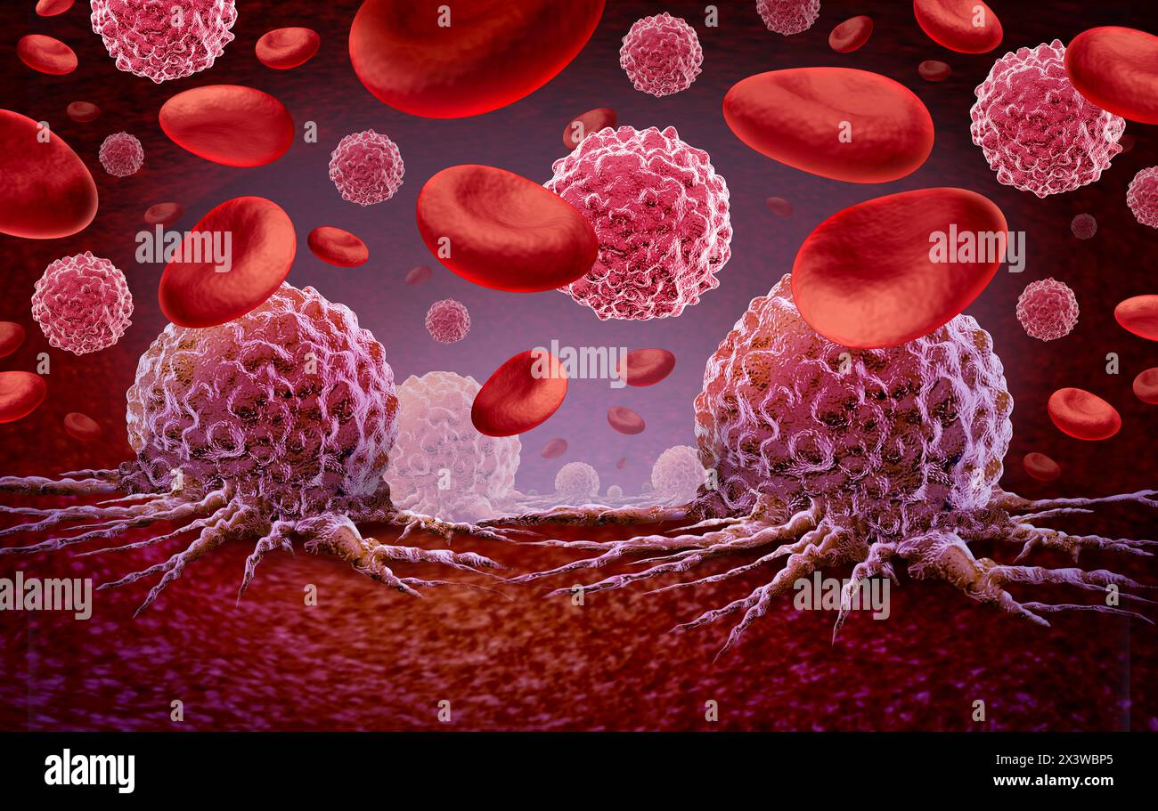 Hematologic cancer hi-res stock photography and images - Alamy