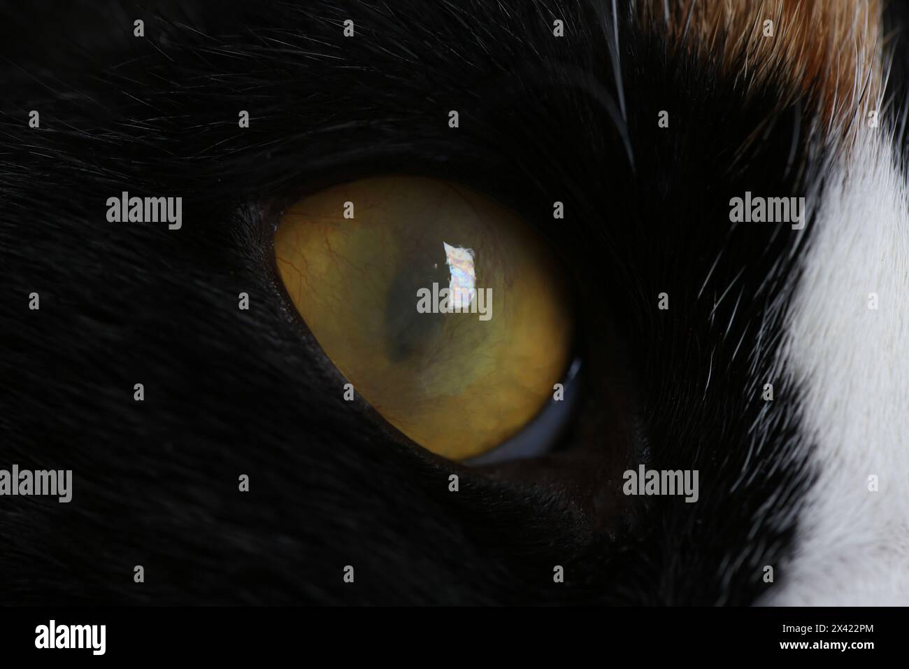 Corneal opacity hi-res stock photography and images - Alamy