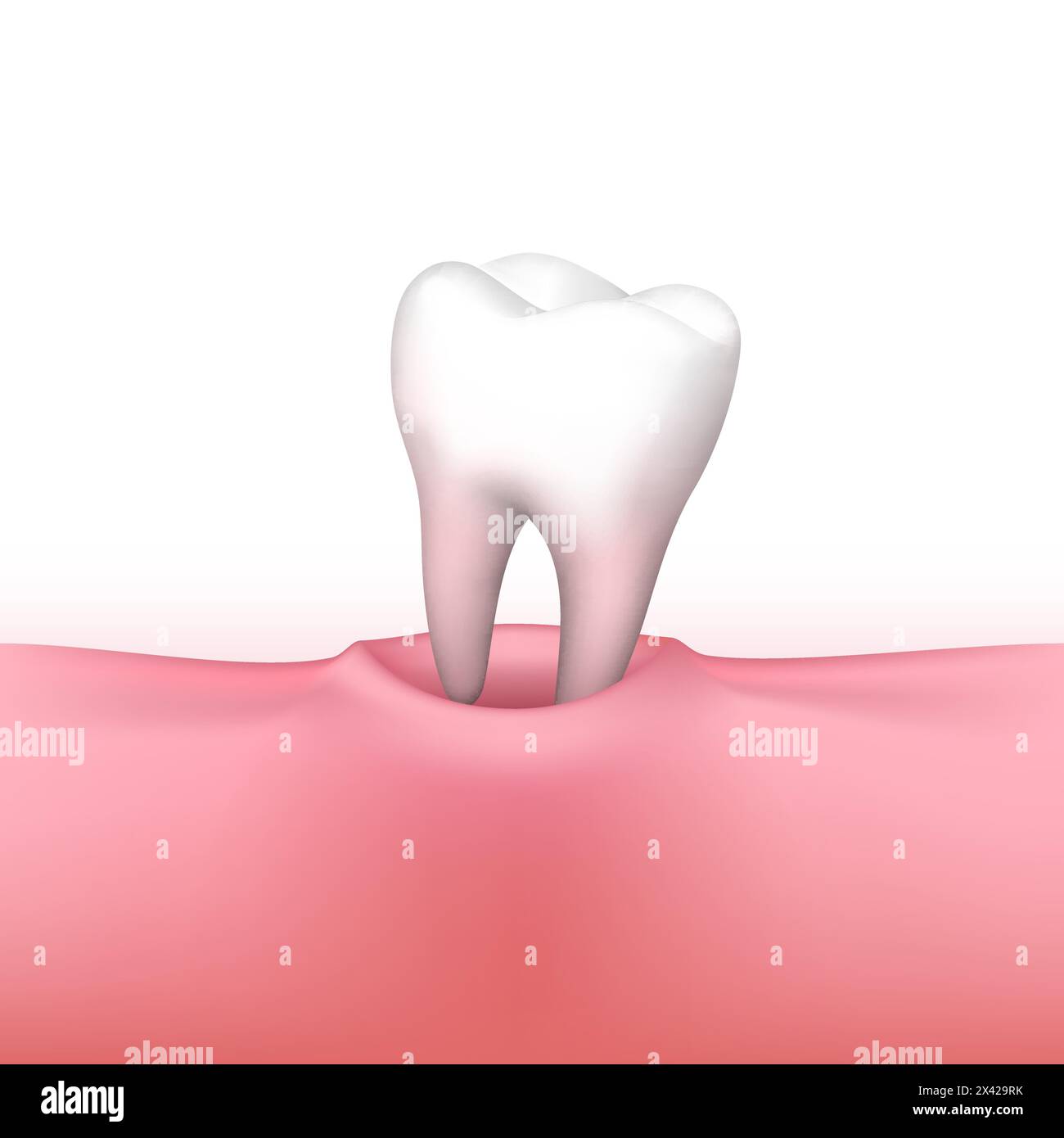 Tooth loss on white background. Vector illustration Stock Vector Image ...