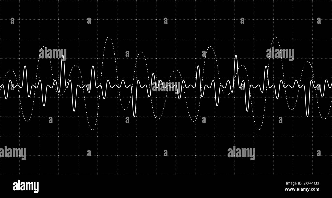 High frequency technology Black and White Stock Photos & Images - Alamy