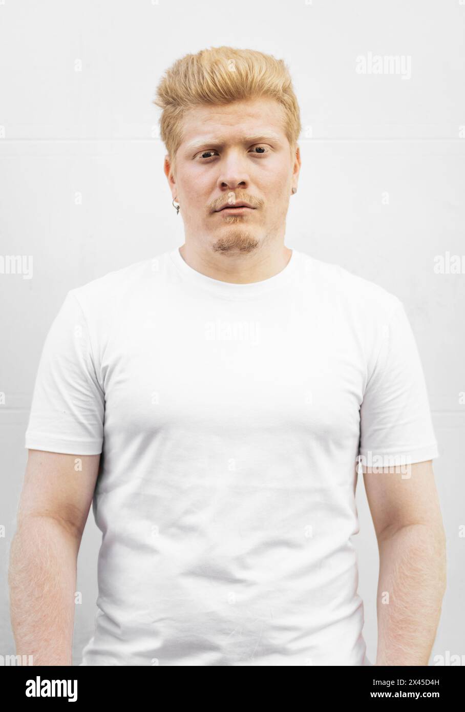Close up portrait of the facial features of a Latino albino man. His ...