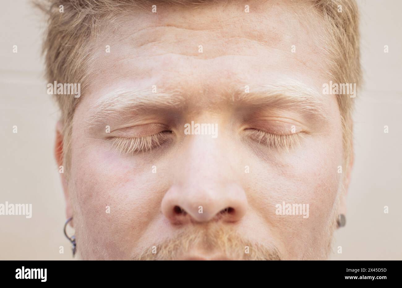 Close up portrait of the facial features of a Latino albino man. His ...