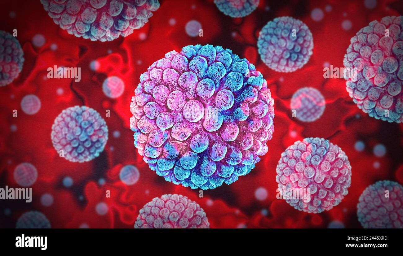 Norovirus outbreak or Norwalk viral infection as a contagious virus ...