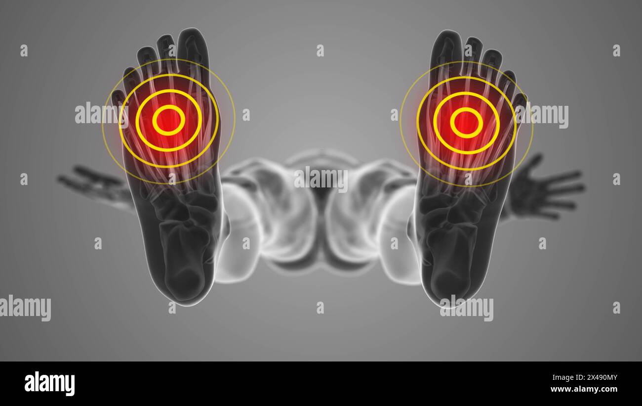 Plantar fascia discomfort in both feet that trigger pain Stock Photo ...