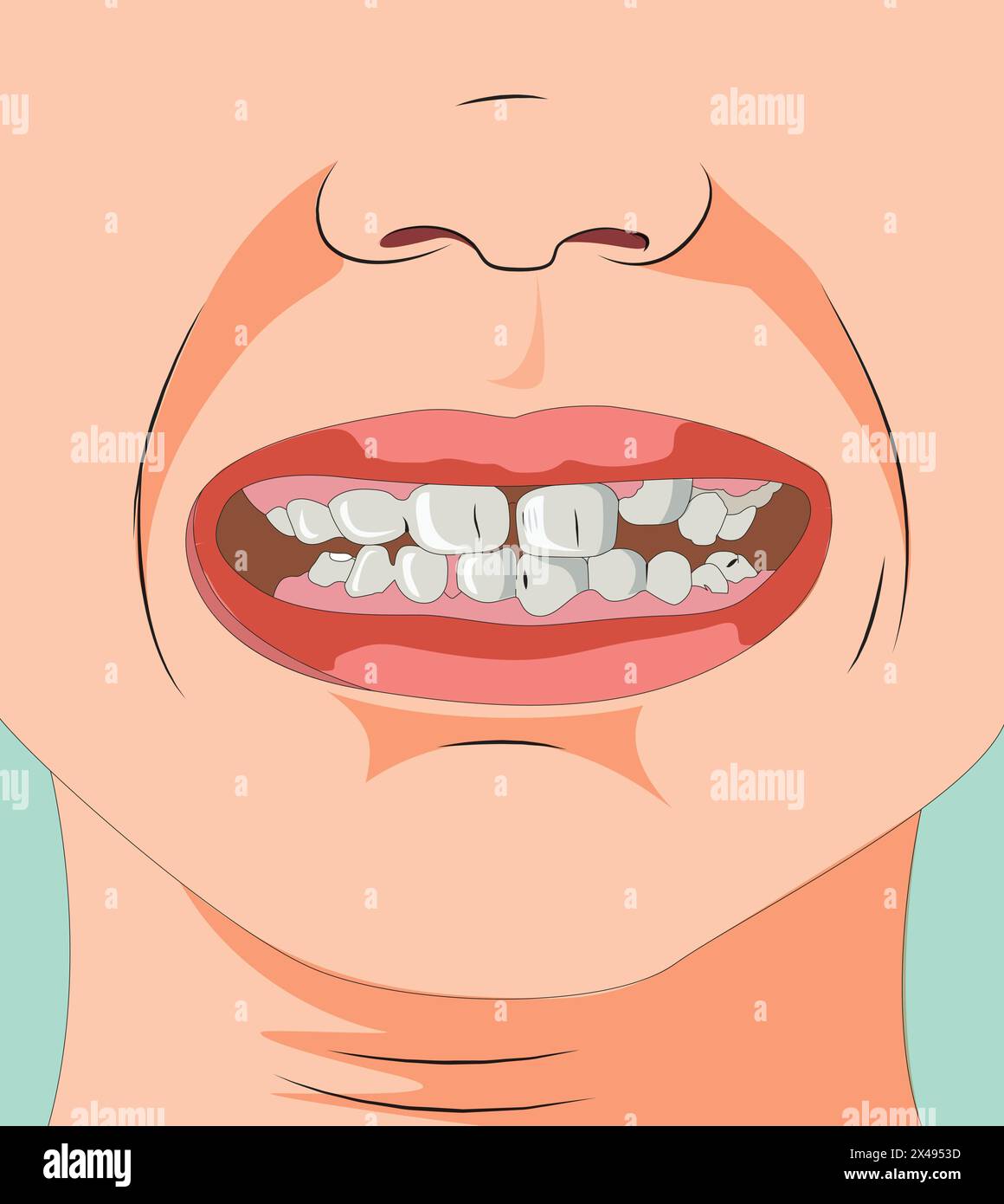 Human mouth illustration showing teeth and nose Stock Vector Image ... Human mouth illustration showing teeth and nose Stock Vector Image ...