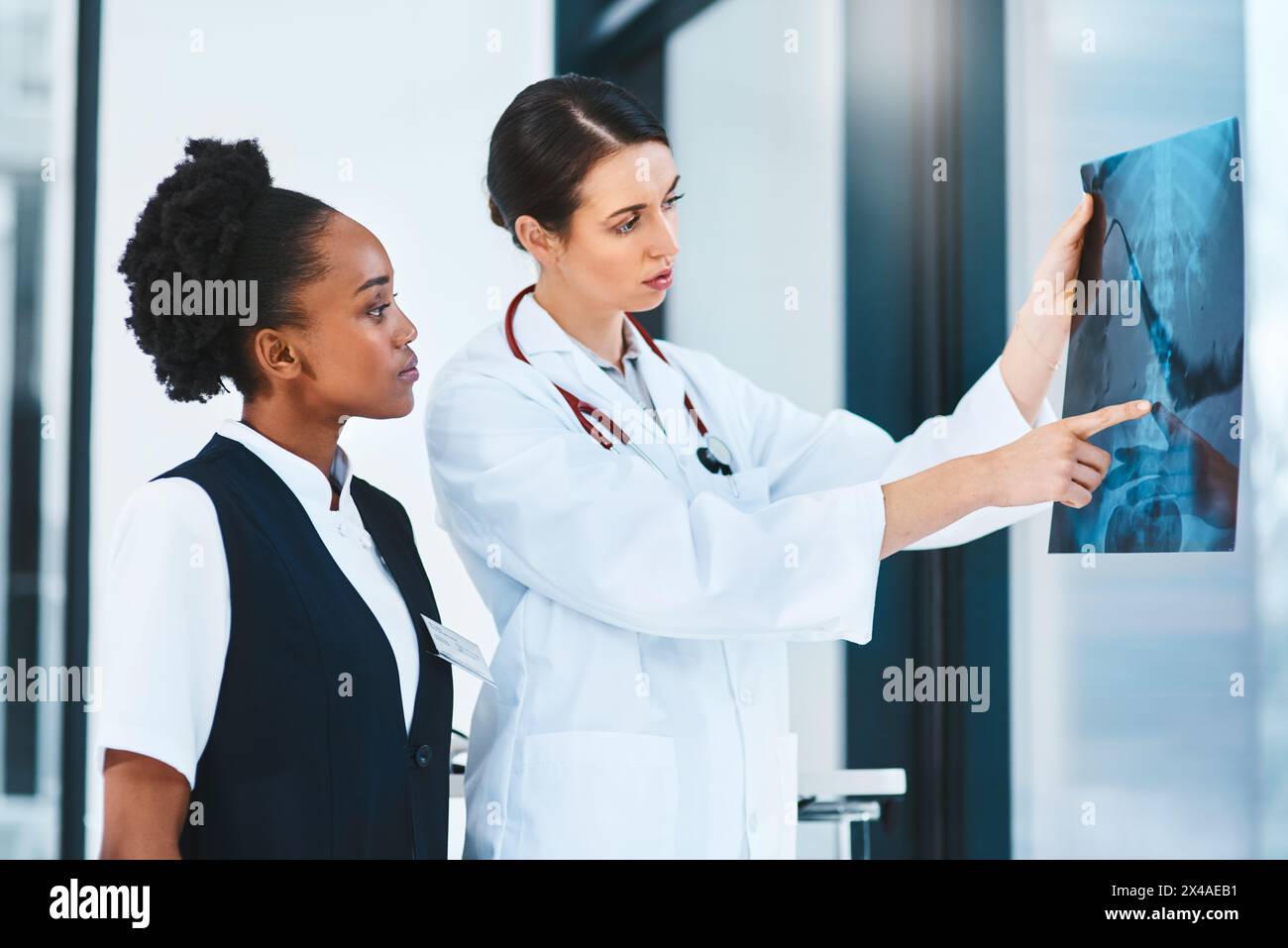 Doctor, team and x ray for exam in hospital, analysis and check results of patient MRI. People ...