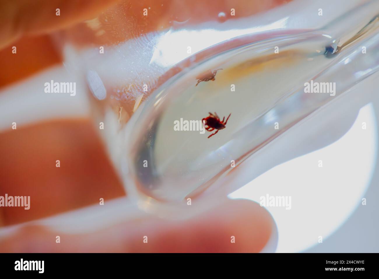 A captivating macro photo captures a scientist examining a tick ...