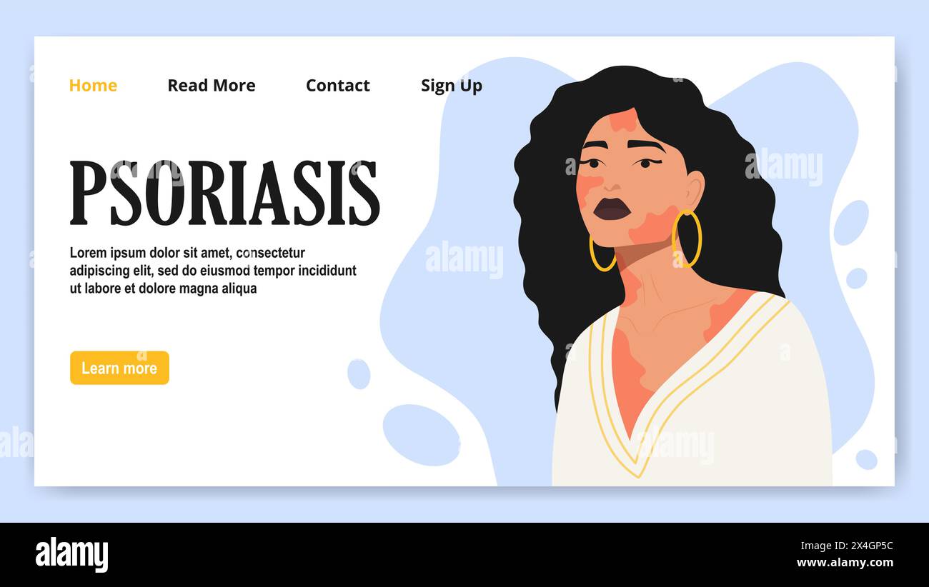 Psoriasis treatment banner, woman with allergic skin inflammation ...