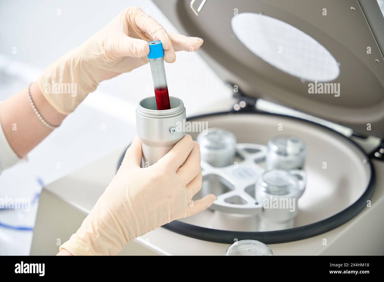 Nurse preparing blood sample for plasma separation in special centrifuge Stock Photo - Alamy