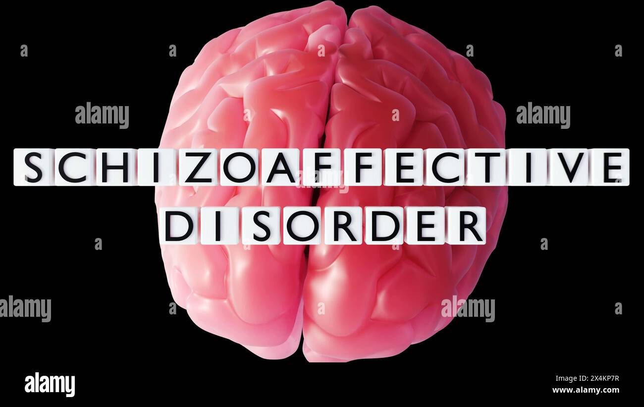 3d rendering brain disorder hi-res stock photography and images - Alamy