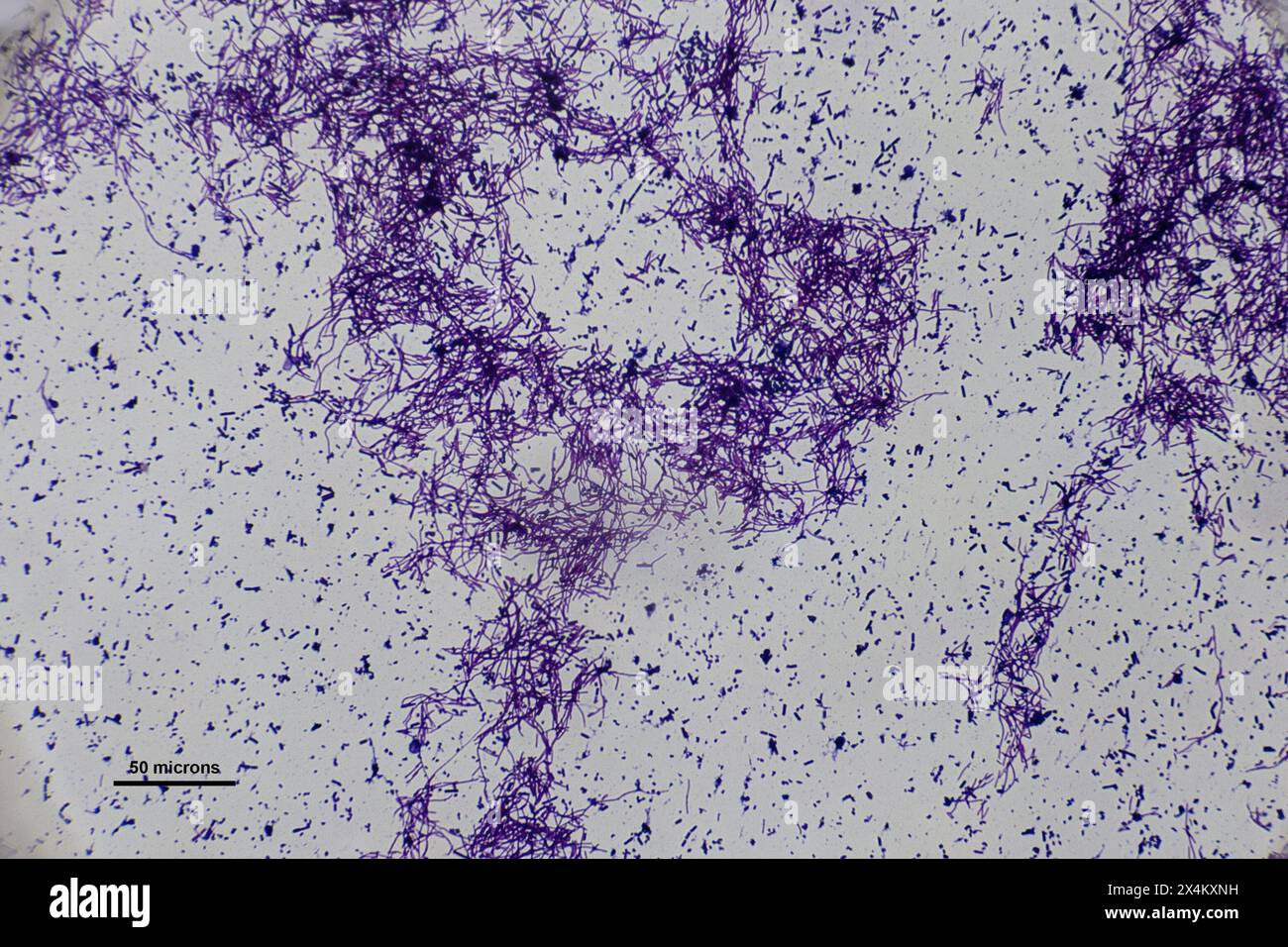 Microscope image of bacteria hi-res stock photography and images - Alamy