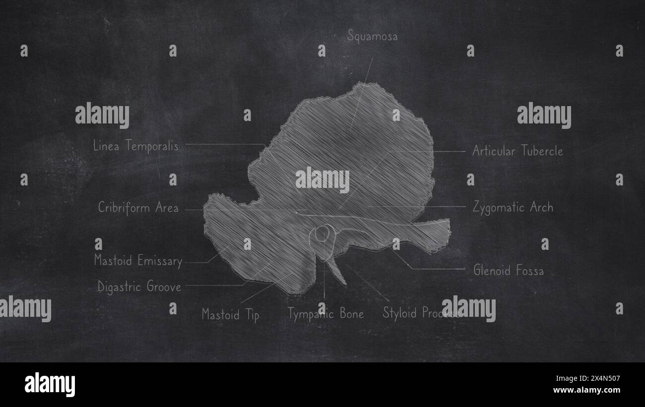 Hand Drawn of Human Anatomy Temporal Bones on Chalkboard Stock Photo ...