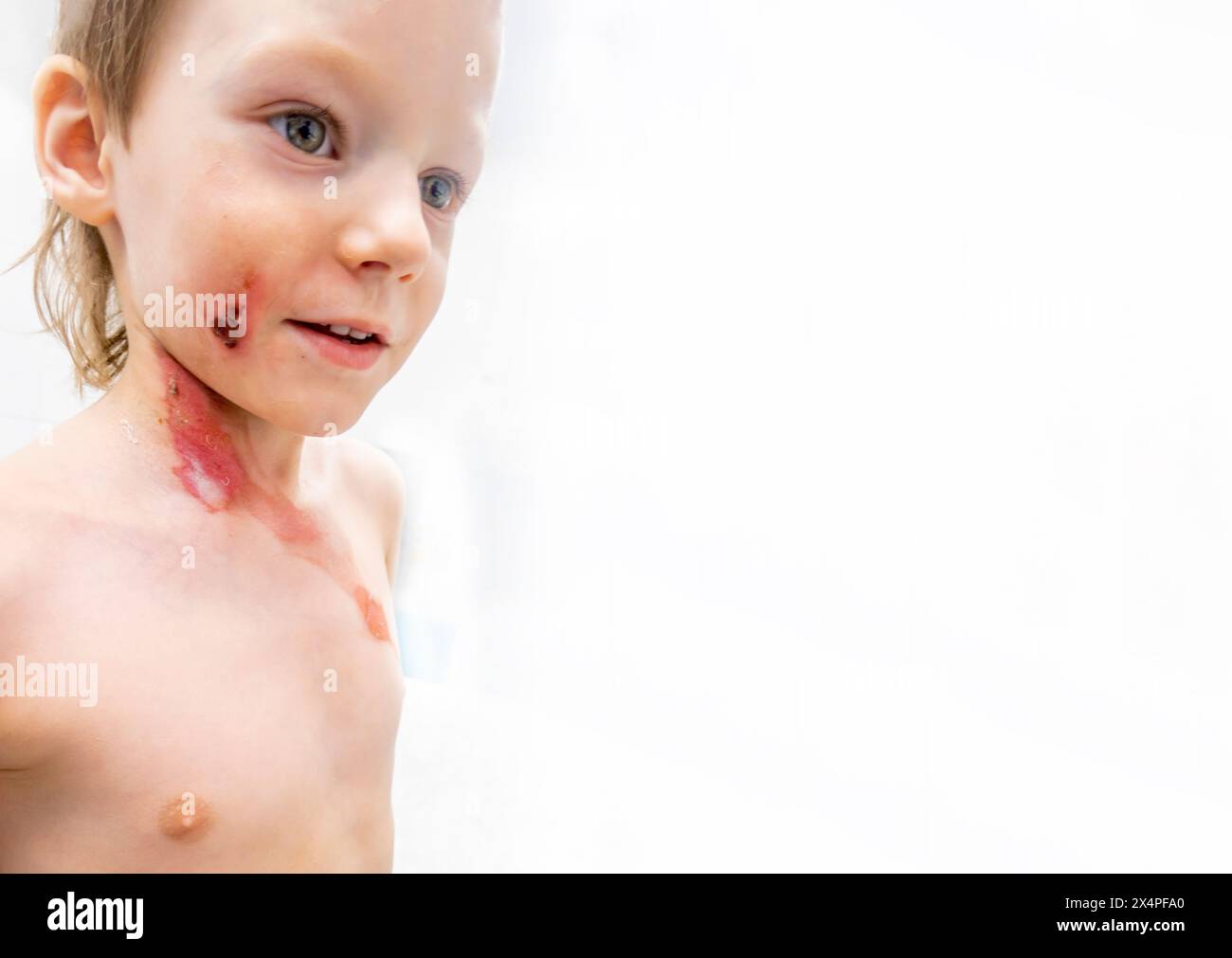 Neck injury boy hi-res stock photography and images - Alamy