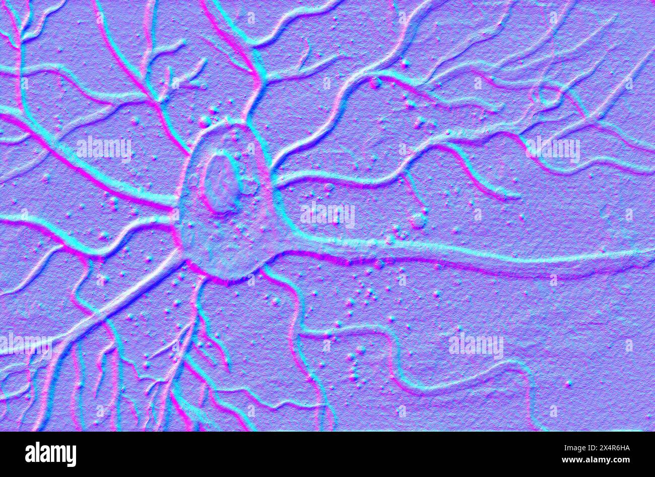 Illustration depicting the motor neuron cell, showing the cell body ...